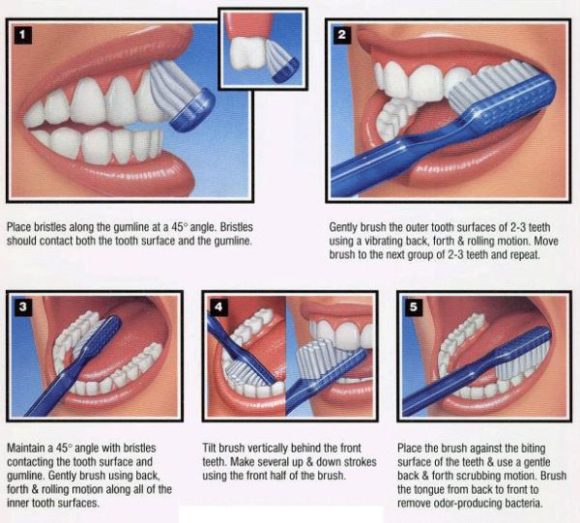 Oral hygiene instructions, Brushing, toothbrush,toothpaste